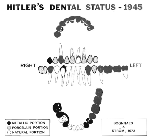 Hitler’s Dental Records – History of Sorts