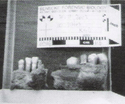 Hitler’s Dental Records – History of Sorts