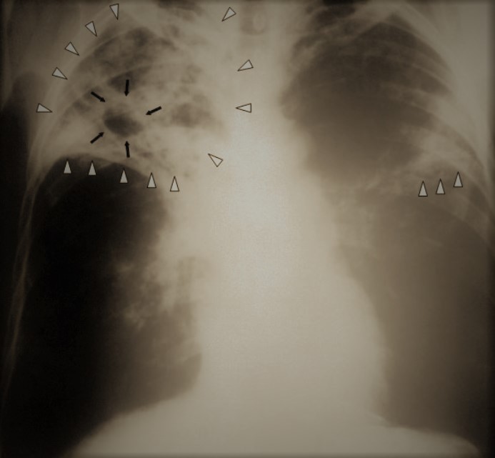 Kurt Heissmeyer-“For me there was no basic difference between human ...